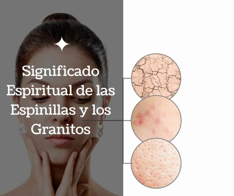 El significado espiritual de las espinillas y los granitos del acné ...